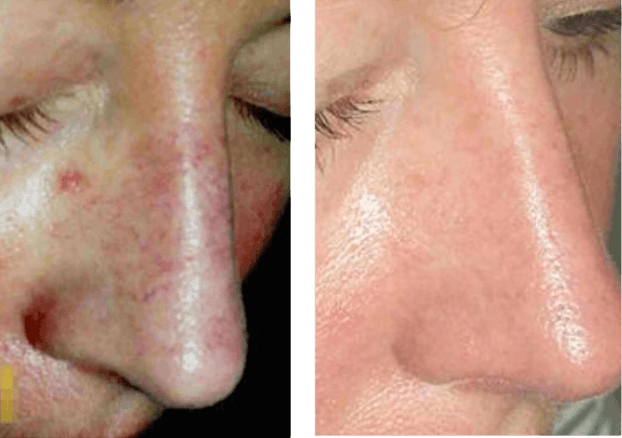 Cosmetics | Craig Singer MD Dermatology